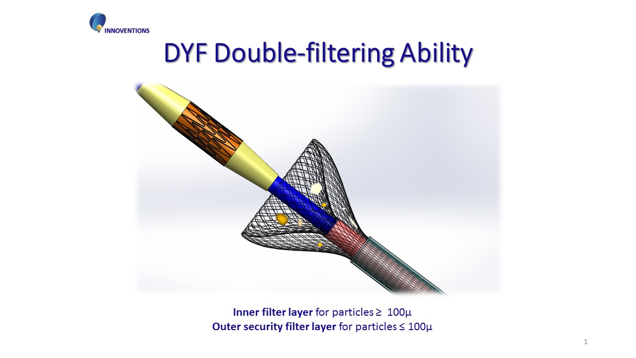 Novel Emboli Capturing and Removal Double-Filtering System for Whole ...
